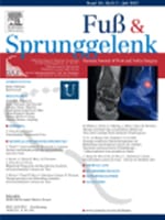 Treatment Options for Chondral and Osteochondral Lesions of the Talus ...