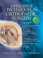Arthrosurface HemiCAP Resurfacing - Arthrosurface