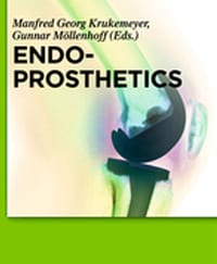 Shoulder Endoprosthetics - Arthrosurface