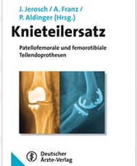 HemiCAP-Implantat - Arthrosurface