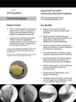HemiCAP® DF MTP Contoured Articular Prosthetic - Arthrosurface
