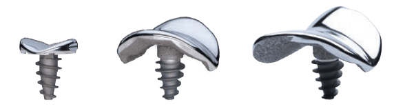 Knee Solutions- Alternatives to Knee Replacement Overview